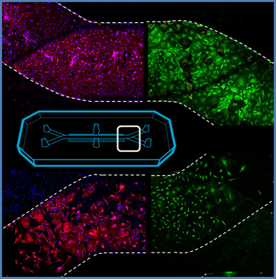 Queen Mary researchers awarded MRC funding to develop human tendon-on-a ...